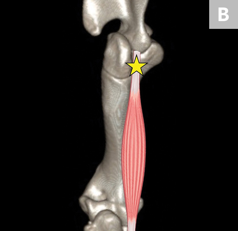 Top 5 Muscle & Tendon Injuries in Lame Patients | Clinician's Brief
