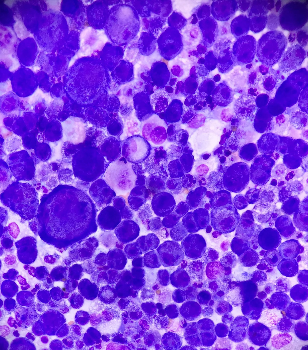 Image Gallery: Transtracheal Wash Cytology | Clinician's Brief