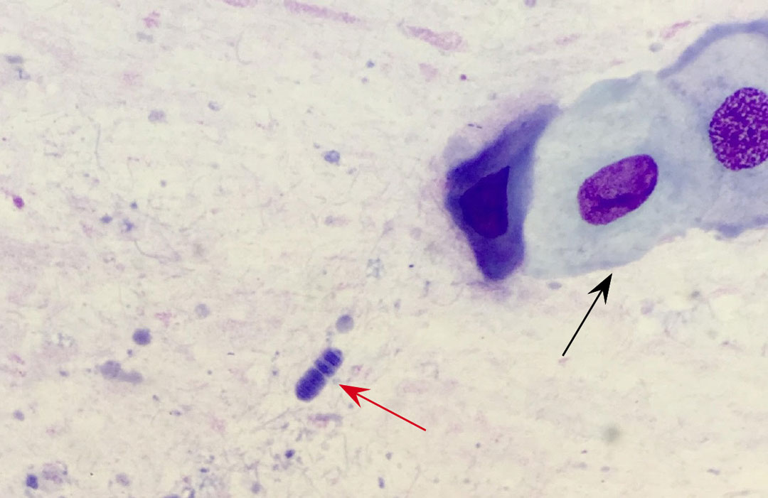 Image Gallery: Transtracheal Wash Cytology | Clinician's Brief