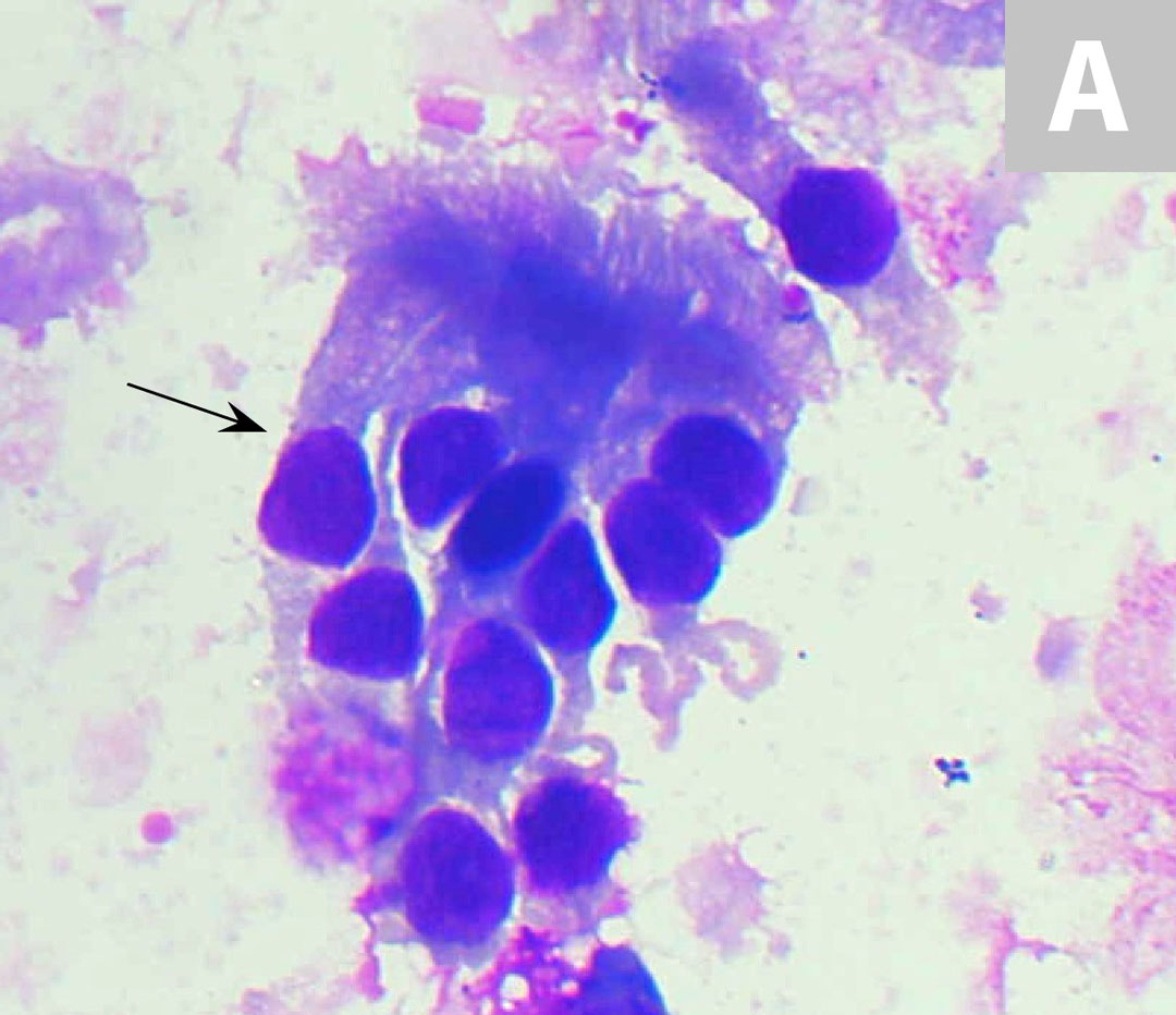 Image Gallery: Transtracheal Wash Cytology | Clinician's Brief