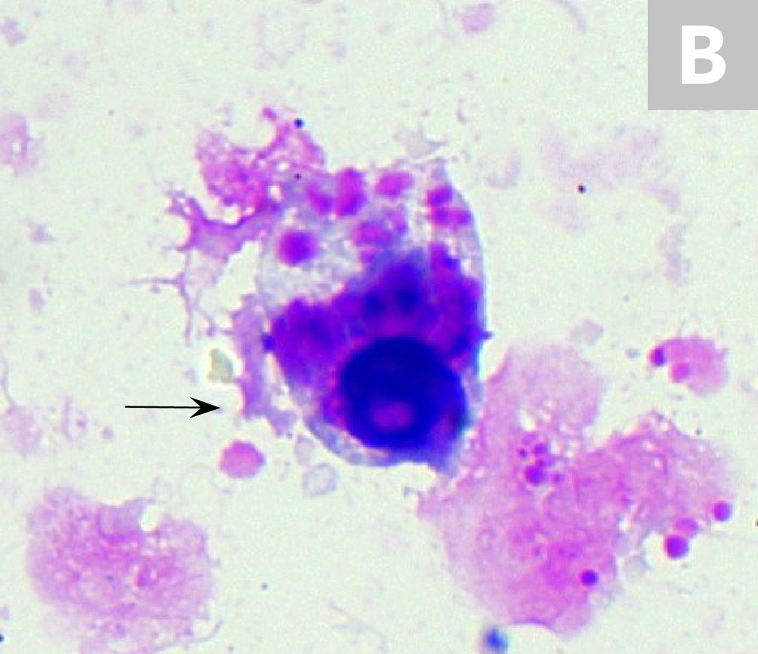 Image Gallery: Transtracheal Wash Cytology | Clinician's Brief