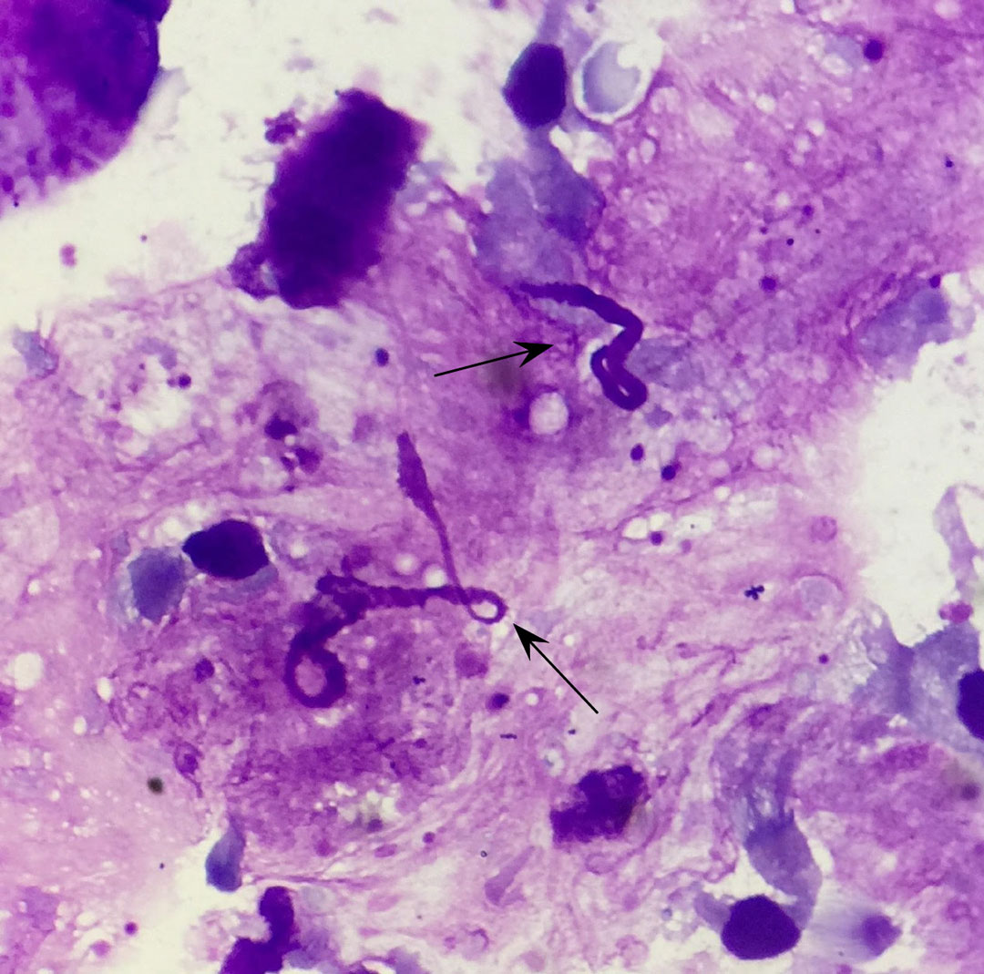 Image Gallery: Transtracheal Wash Cytology | Clinician's Brief