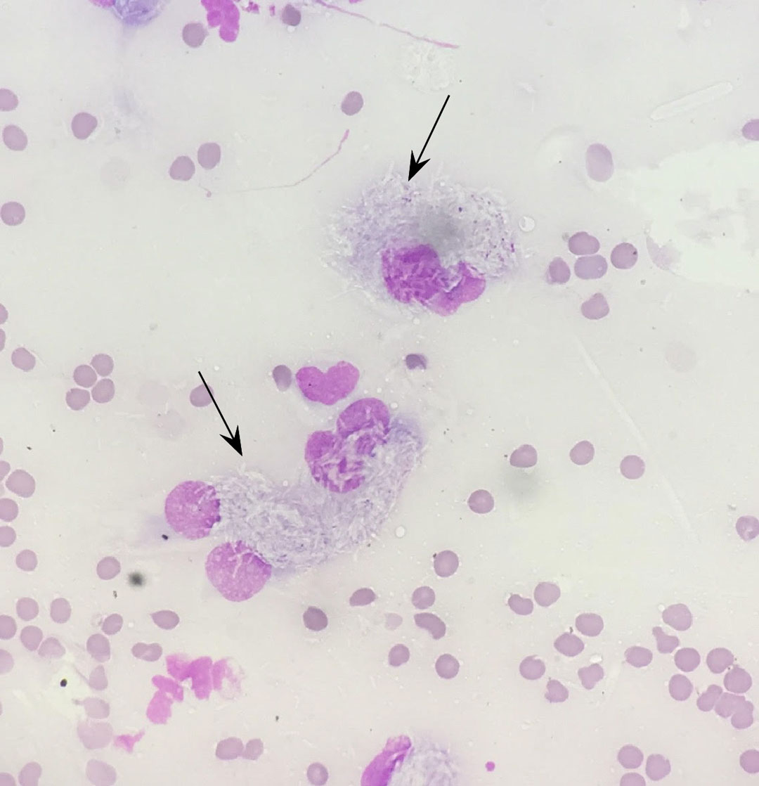 Image Gallery: Transtracheal Wash Cytology | Clinician's Brief