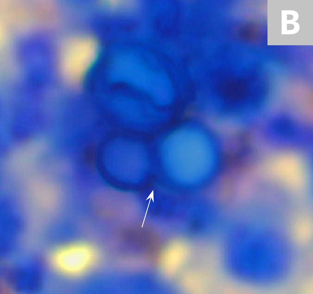 Image Gallery: Transtracheal Wash Cytology | Clinician's Brief