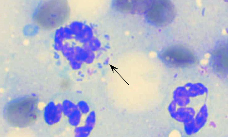 Image Gallery: Transtracheal Wash Cytology | Clinician's Brief