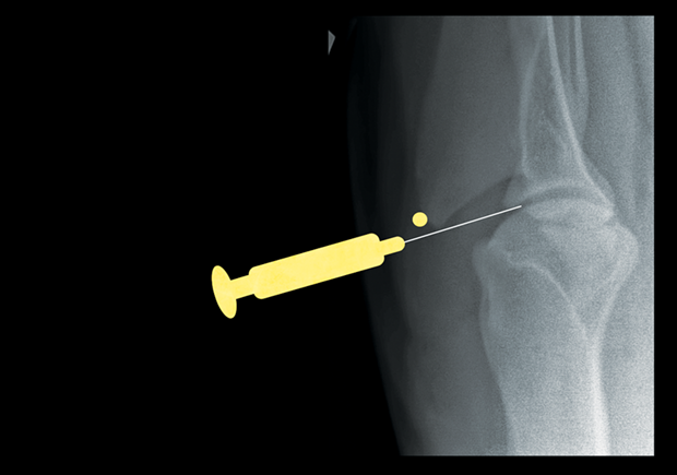 Arthrocentesis in Dogs | Clinician's Brief