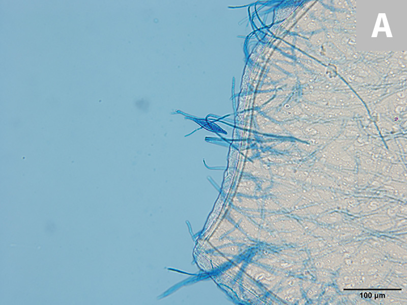 Fungal Cultures | Clinician's Brief