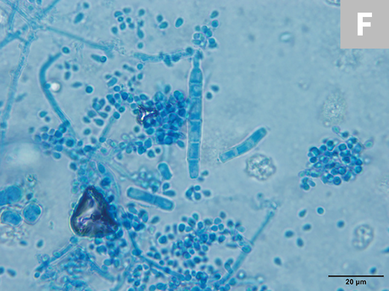Fungal Cultures | Clinician's Brief