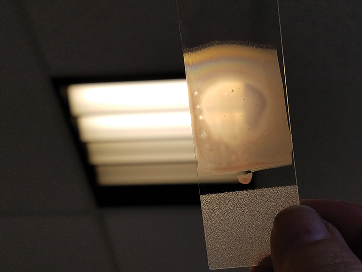Diagnostic Blood Smear Preparation | Clinician's Brief