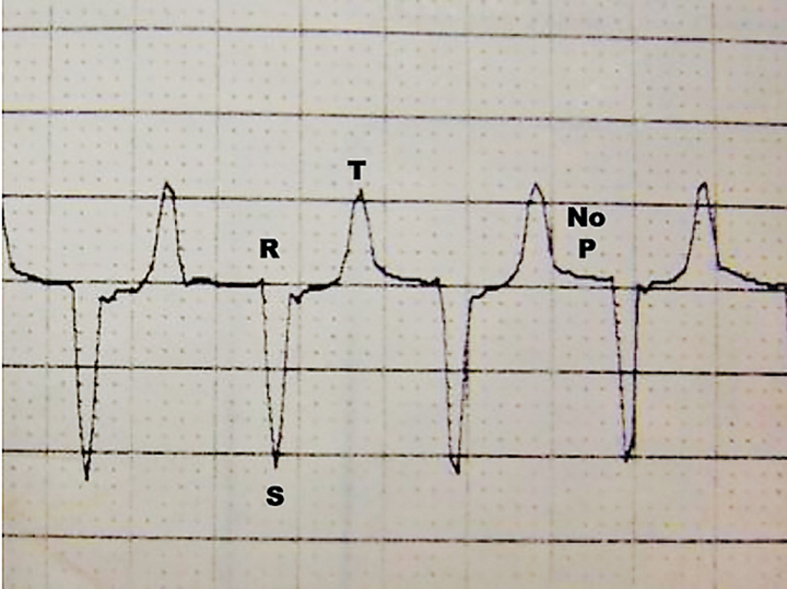 Top 5 Mechanisms of Adverse Drug Events in the Intensive Care Unit ...