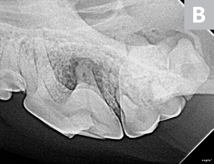 Complicated Crown Fractures in Dogs | Clinician's Brief