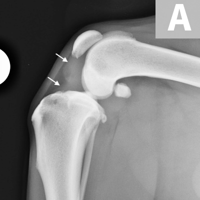 Image Quiz: Abnormal Canine Stifle Radiographs | Clinician's Brief