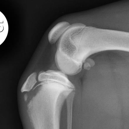 Image Quiz: Abnormal Canine Stifle Radiographs | Clinician's Brief