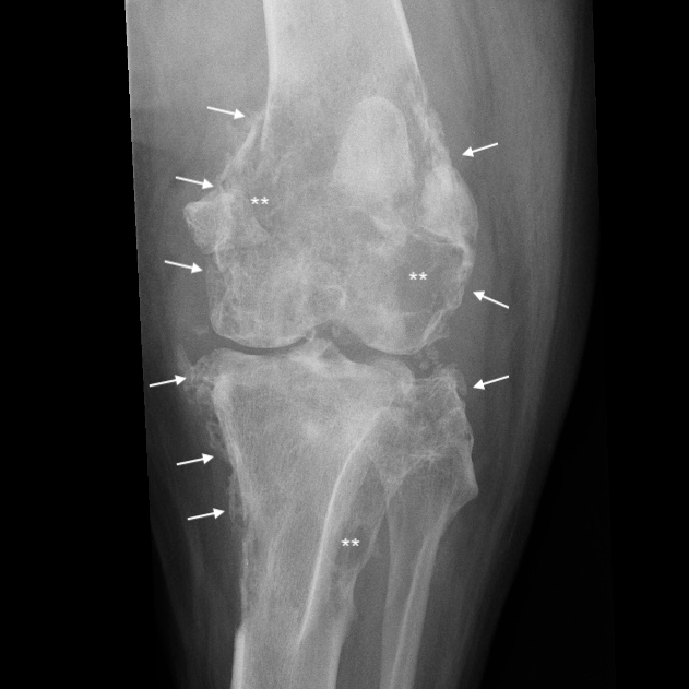 Image Quiz: Abnormal Canine Stifle Radiographs | Clinician's Brief