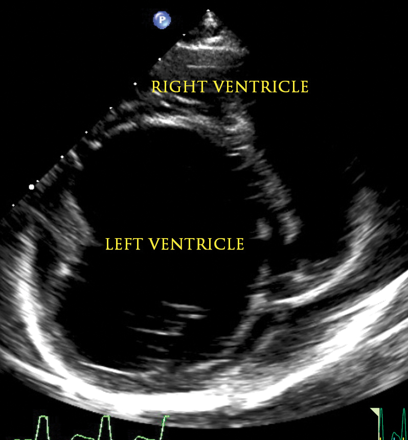 Respiratory Distress & Inappetence in a Border Collie | Clinician's Brief
