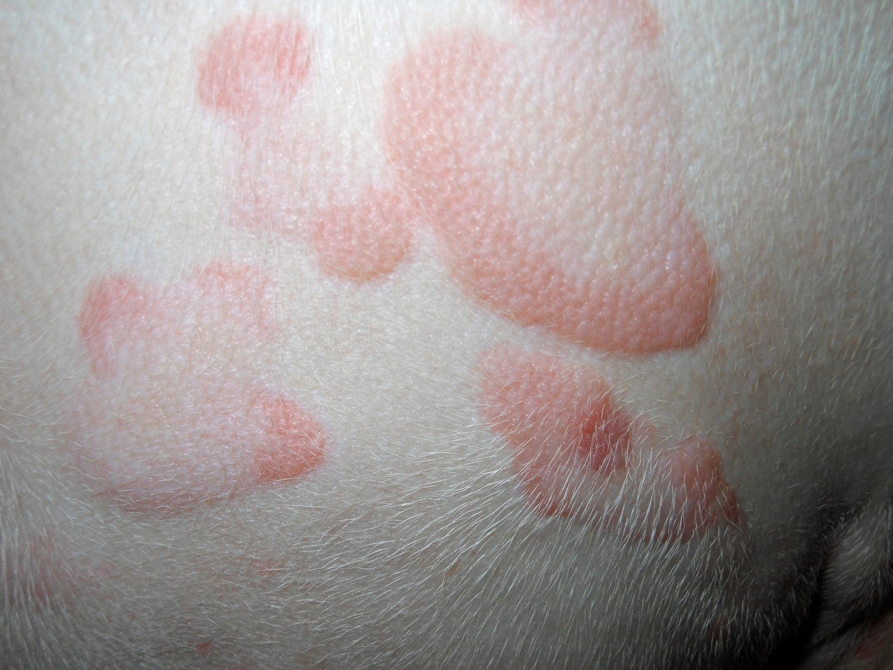 Image Gallery: Primary Skin Lesions | Clinician's Brief