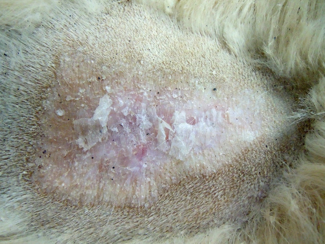Image Gallery: Secondary Skin Lesions | Clinician's Brief