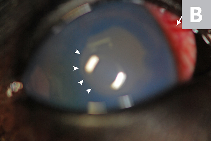 Cloudy Eye in a Labrador Retriever | Clinician's Brief
