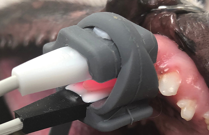 Top 5 Methods for Assessing Tooth Vitality | Clinician's Brief