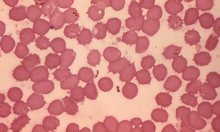 Plague in Dogs & Cats with Dr. Davis | Clinician's Brief