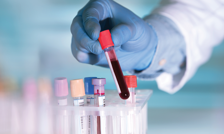 Differential Diagnosis: Hyperphosphatemia | Clinician's Brief