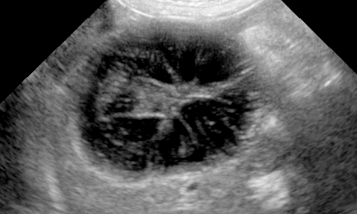 Top 5 Canine Biliary Diseases | Clinician's Brief