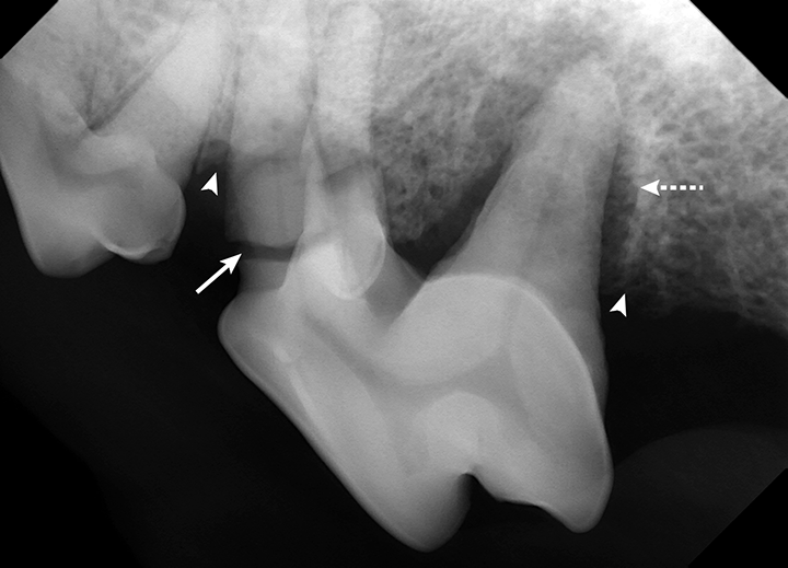 Treating Fractured Teeth in a Dog | Clinician's Brief