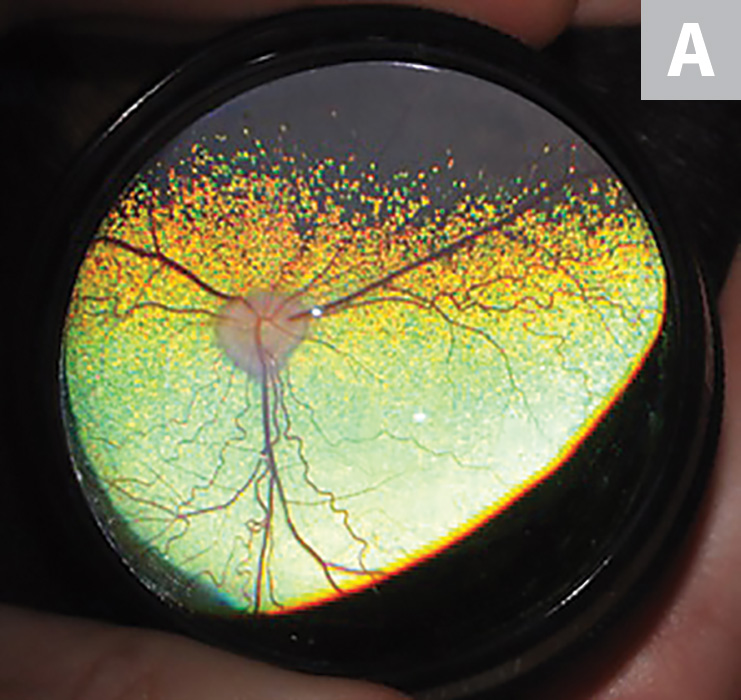 Fundic Examination | Clinician's Brief