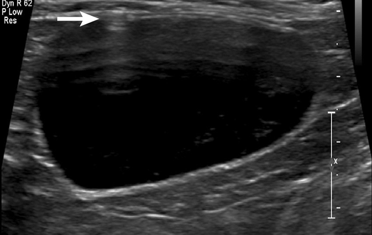 Guide to Performing Cystocentesis in Dogs & Cats | Clinician's Brief