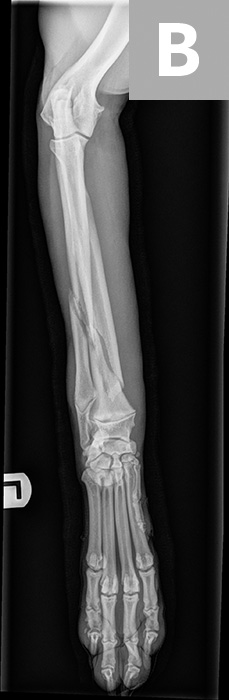 Quiz: External Coaptation vs Surgical Fixation for Bone Fractures ...
