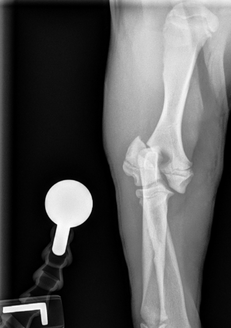 Quiz: External Coaptation vs Surgical Fixation for Bone Fractures ...