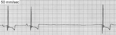 Interpreting ECGs with Confidence: Part 2 | Clinician's Brief
