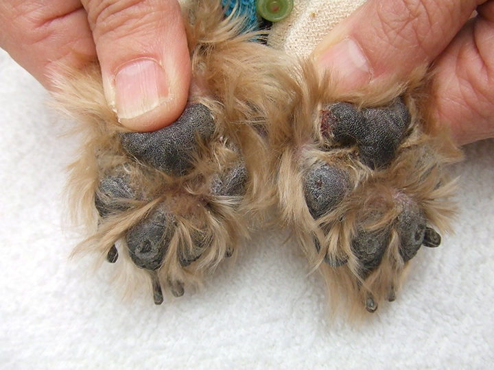 Visual Guide to Immune-Mediated Skin Diseases | Clinician's Brief