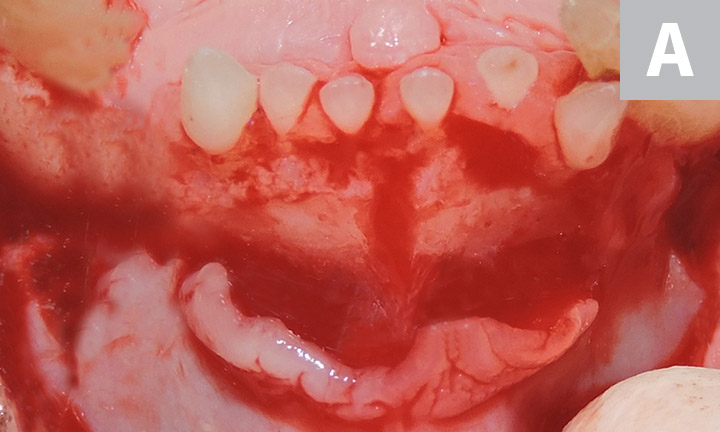 Maxillary Extractions in Cats | Clinician's Brief
