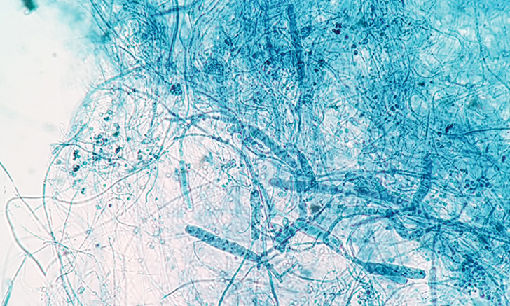 Dermatophytosis with Dr. Moriello | Clinician's Brief
