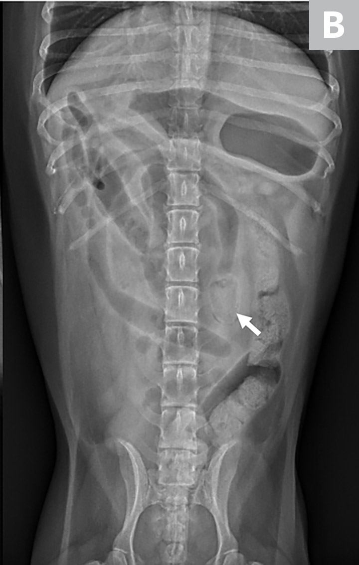 GI Obstruction on Radiographs | Clinician's Brief