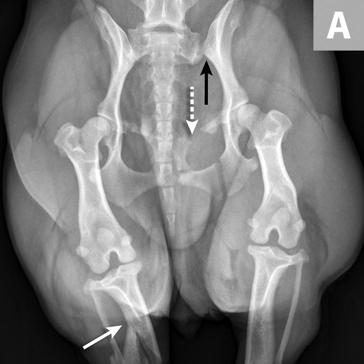 Pelvic Fractures | Clinician's Brief