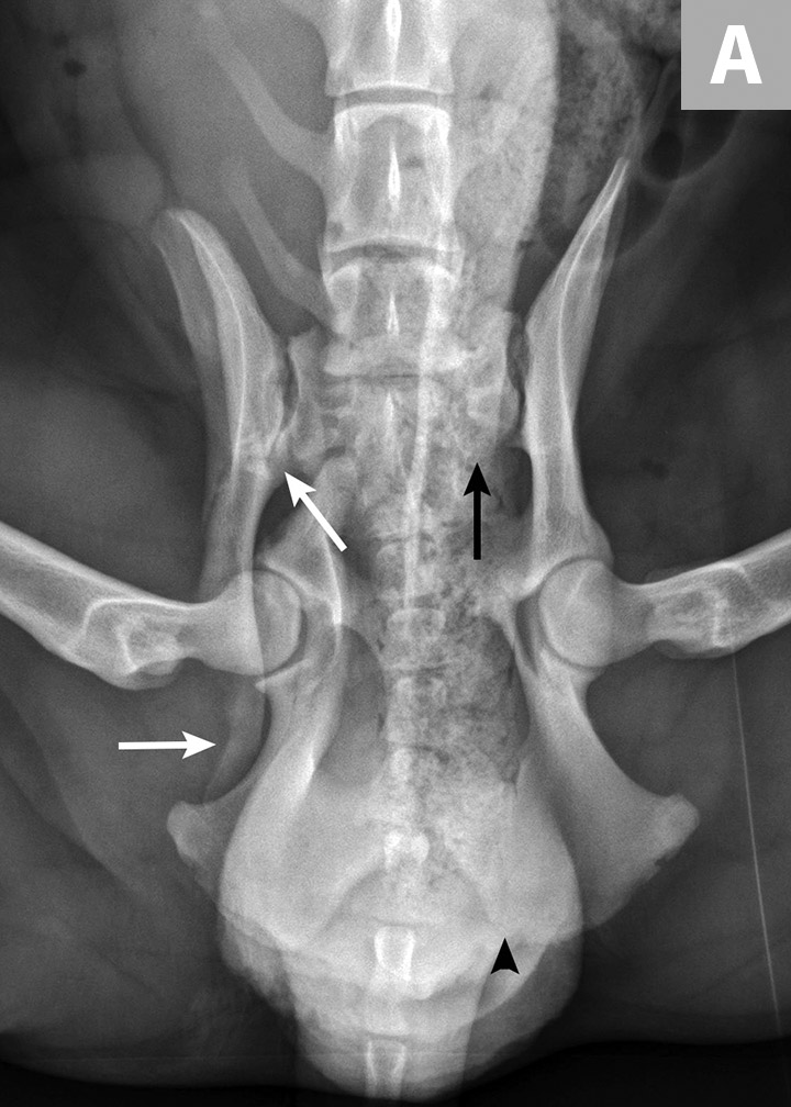 Pelvic Fractures | Clinician's Brief