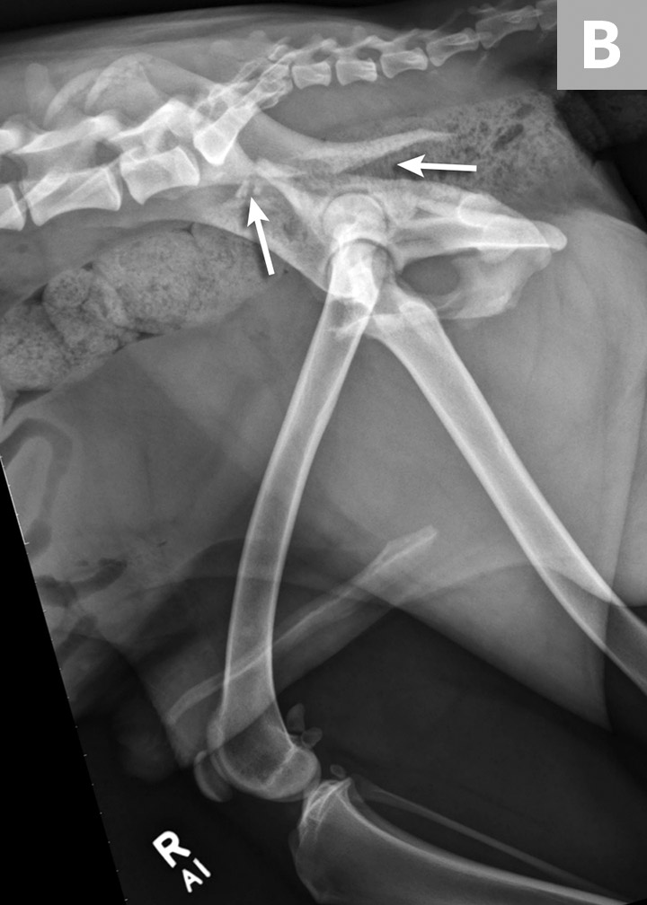 Pelvic Fractures | Clinician's Brief