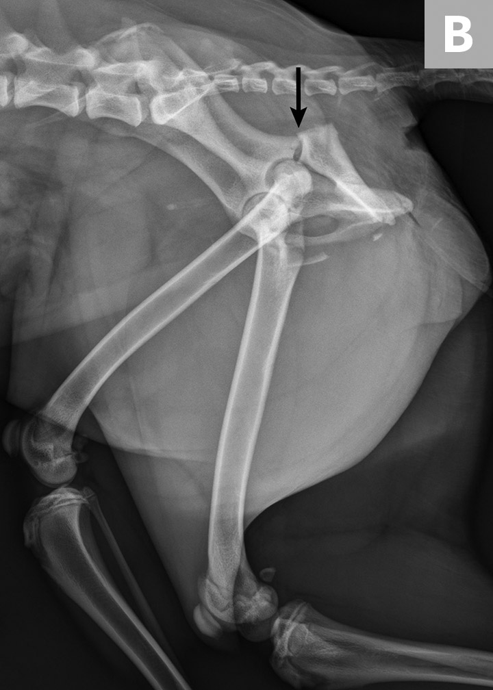 Pelvic Fractures | Clinician's Brief