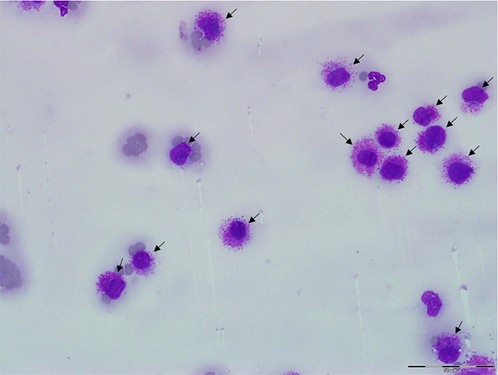 Top 5 Abnormalities Missed When a Blood Film Is Not Examined ...