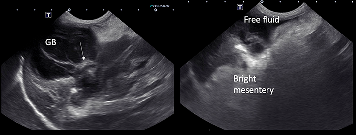 Hepatobiliary Imaging with Radiography & Ultrasonography: Biliary ...