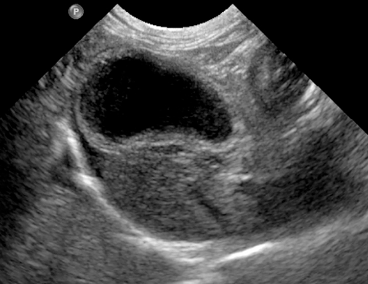 Hepatobiliary Imaging with Radiography & Ultrasonography: Biliary ...