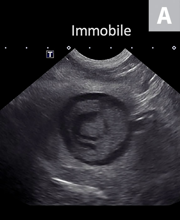 Hepatobiliary Imaging with Radiography & Ultrasonography: Biliary ...