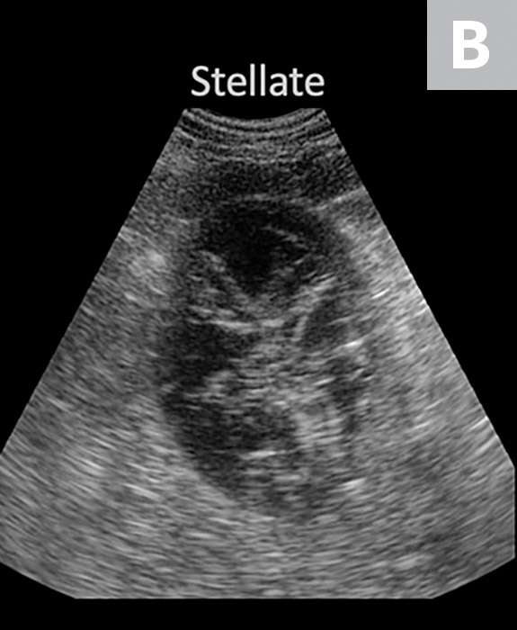 Hepatobiliary Imaging with Radiography & Ultrasonography: Biliary ...