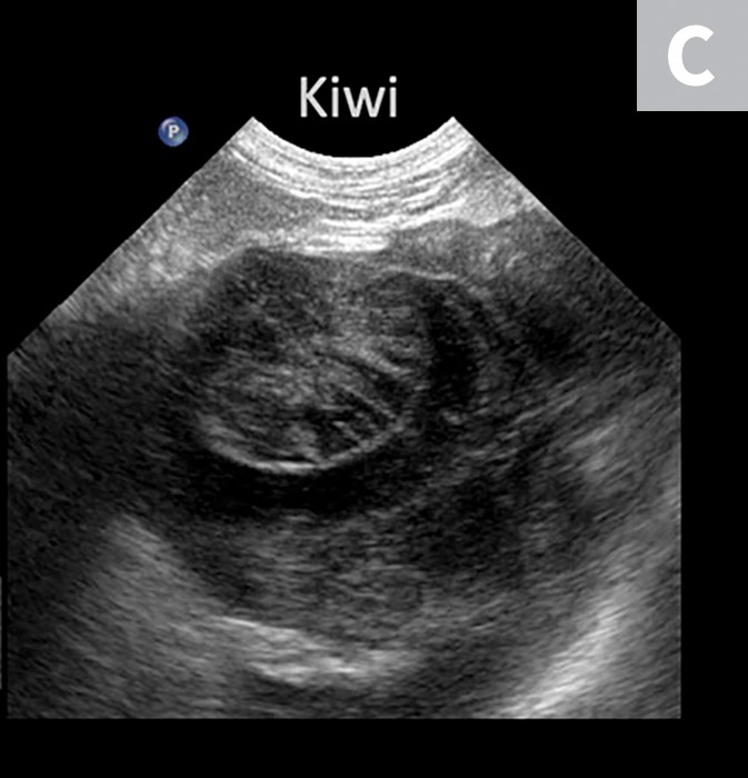 Hepatobiliary Imaging with Radiography & Ultrasonography: Biliary ...