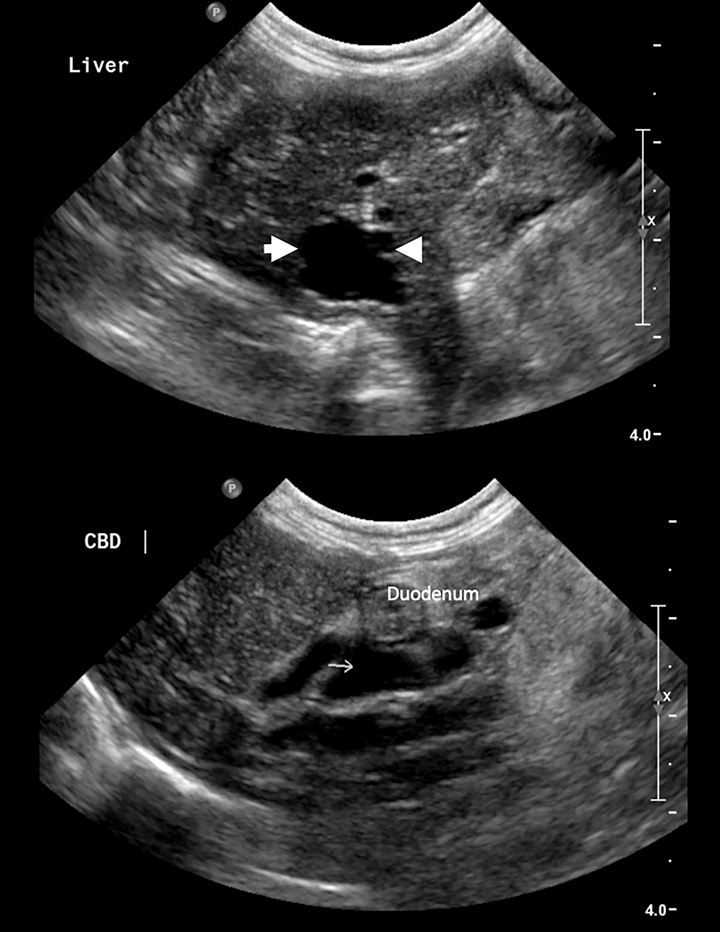 Hepatobiliary Imaging with Radiography & Ultrasonography: Biliary ...