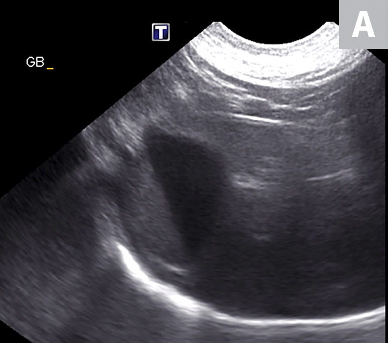 Hepatobiliary Imaging with Radiography & Ultrasonography: Biliary ...