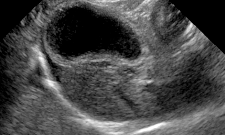 Hepatobiliary Imaging with Radiography & Ultrasonography: Biliary ...