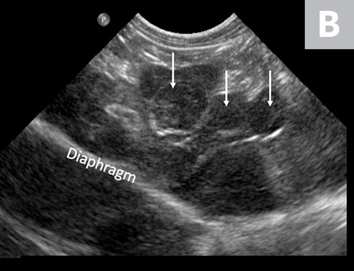 Hepatobiliary Imaging with Radiography & Ultrasonography: Liver ...